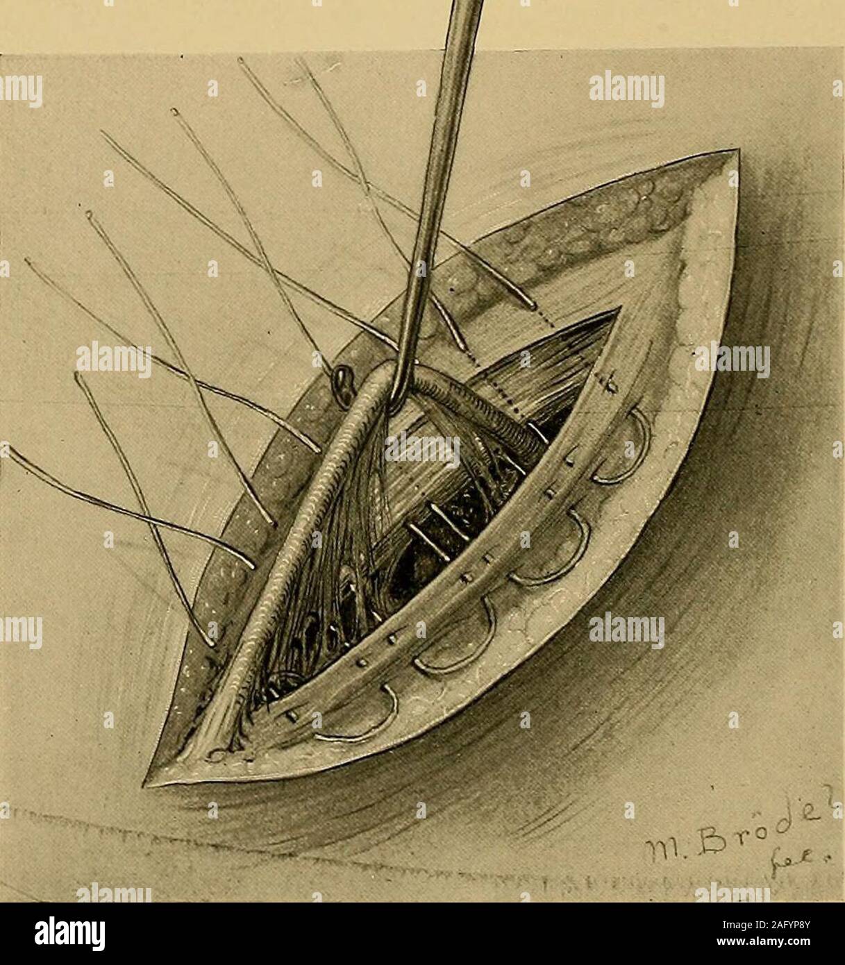 Linea alba hi-res stock photography and images - Alamy