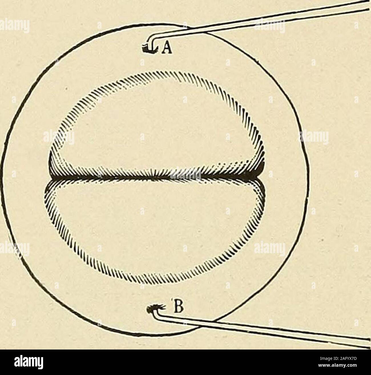 . The diagnosis and treatment of diseases of women. Fig. 440 ...