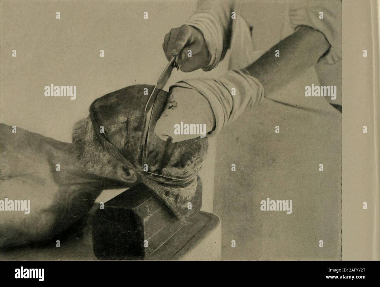 . Post-mortem pathology; a manual of post-mortem examinations and the ...