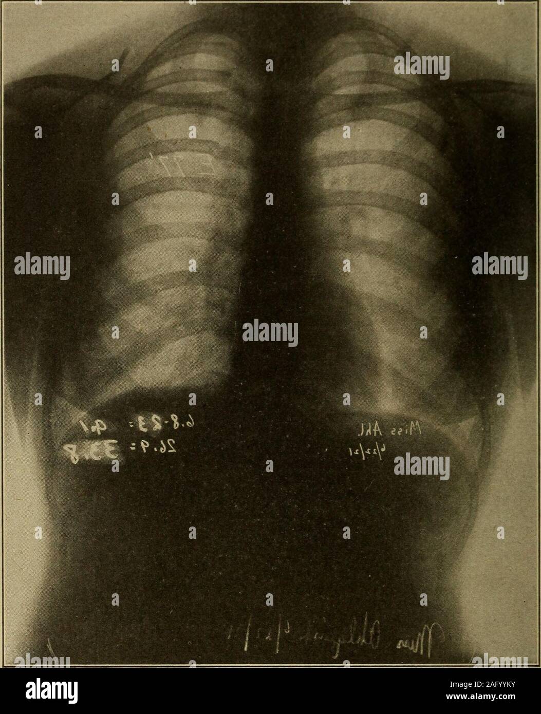 Fatigability hi-res stock photography and images - Alamy