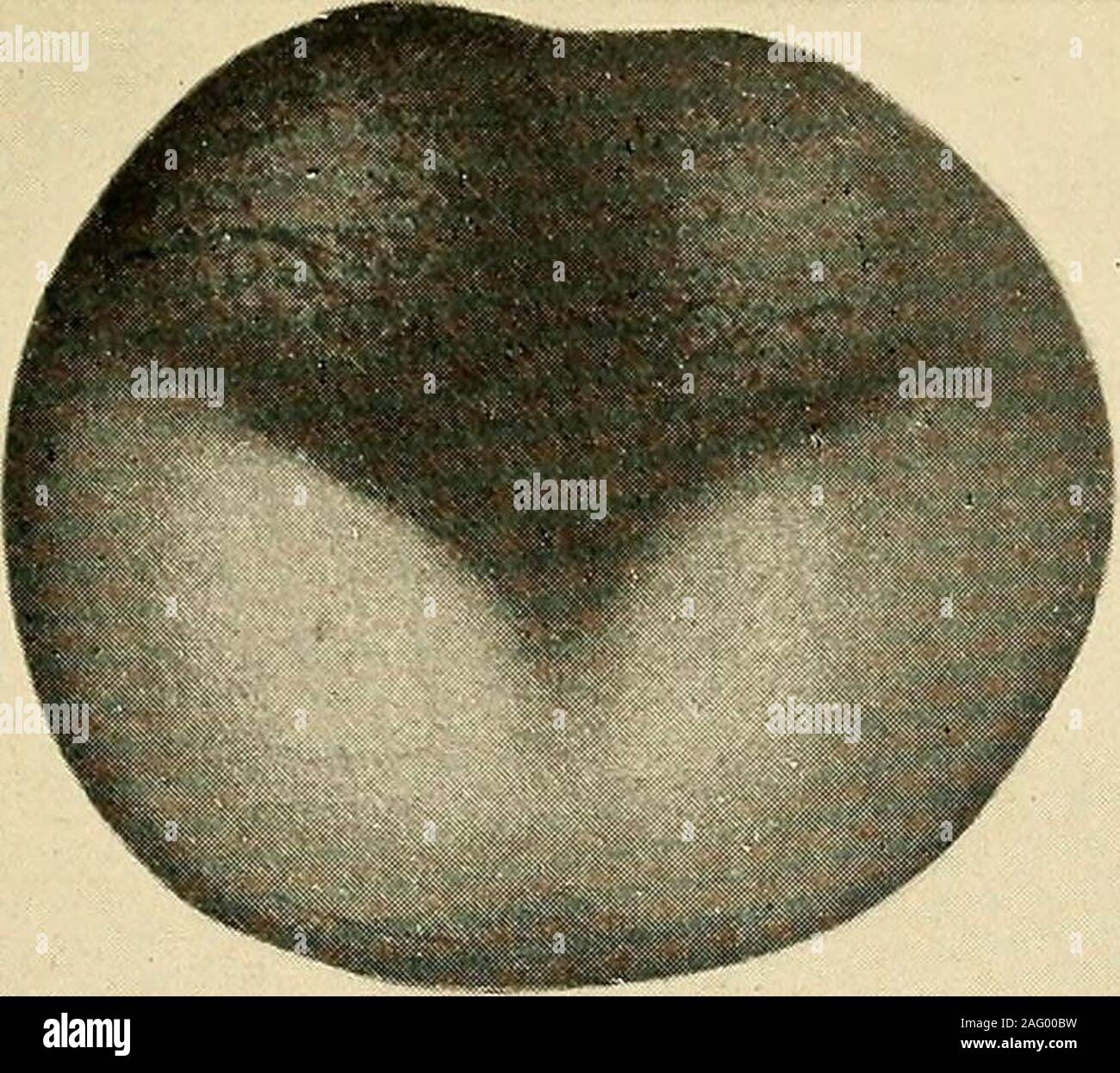 . The diagnosis and treatment of diseases of women. Fig. 439 ...