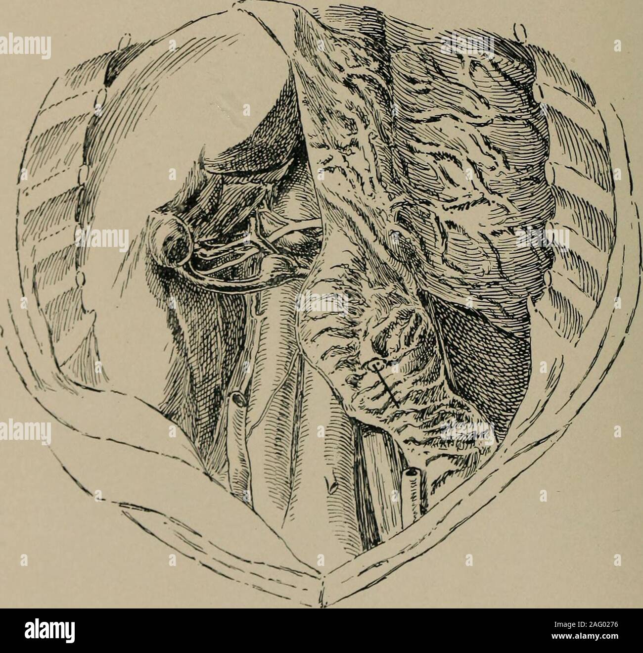. Post-mortem pathology; a manual of post-mortem examinations and the ...
