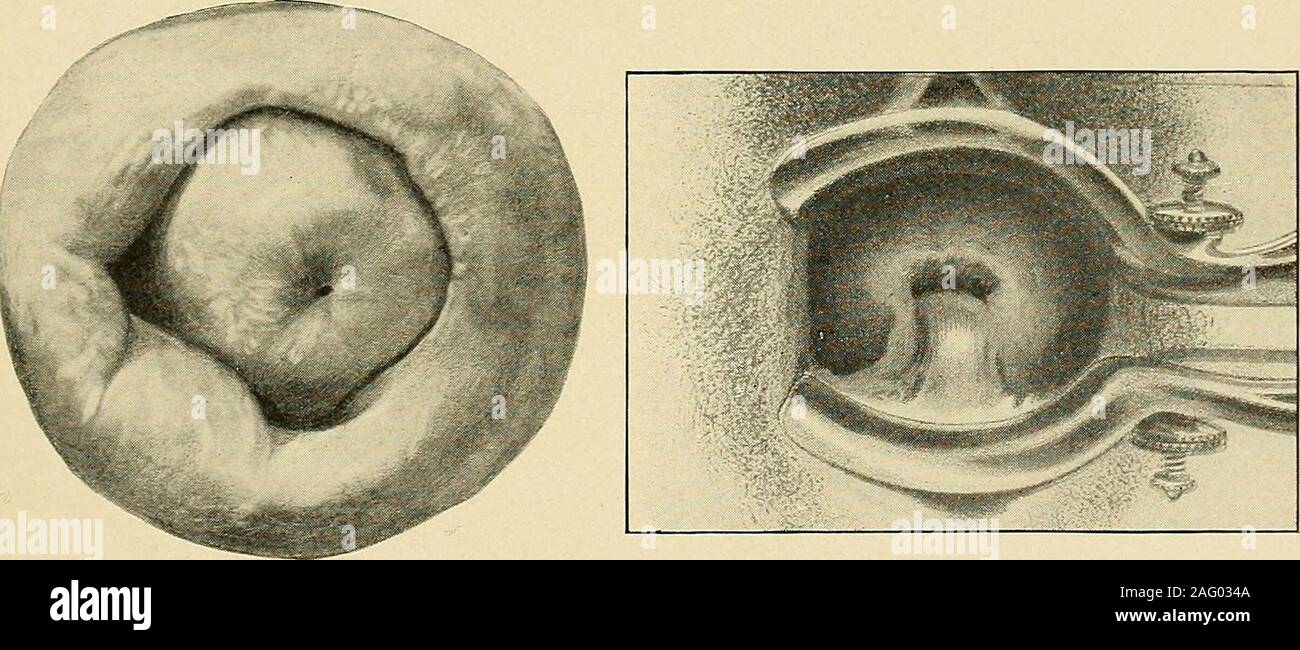 . The diagnosis and treatment of diseases of women. Fig. 432. Fig. 4.33 ...