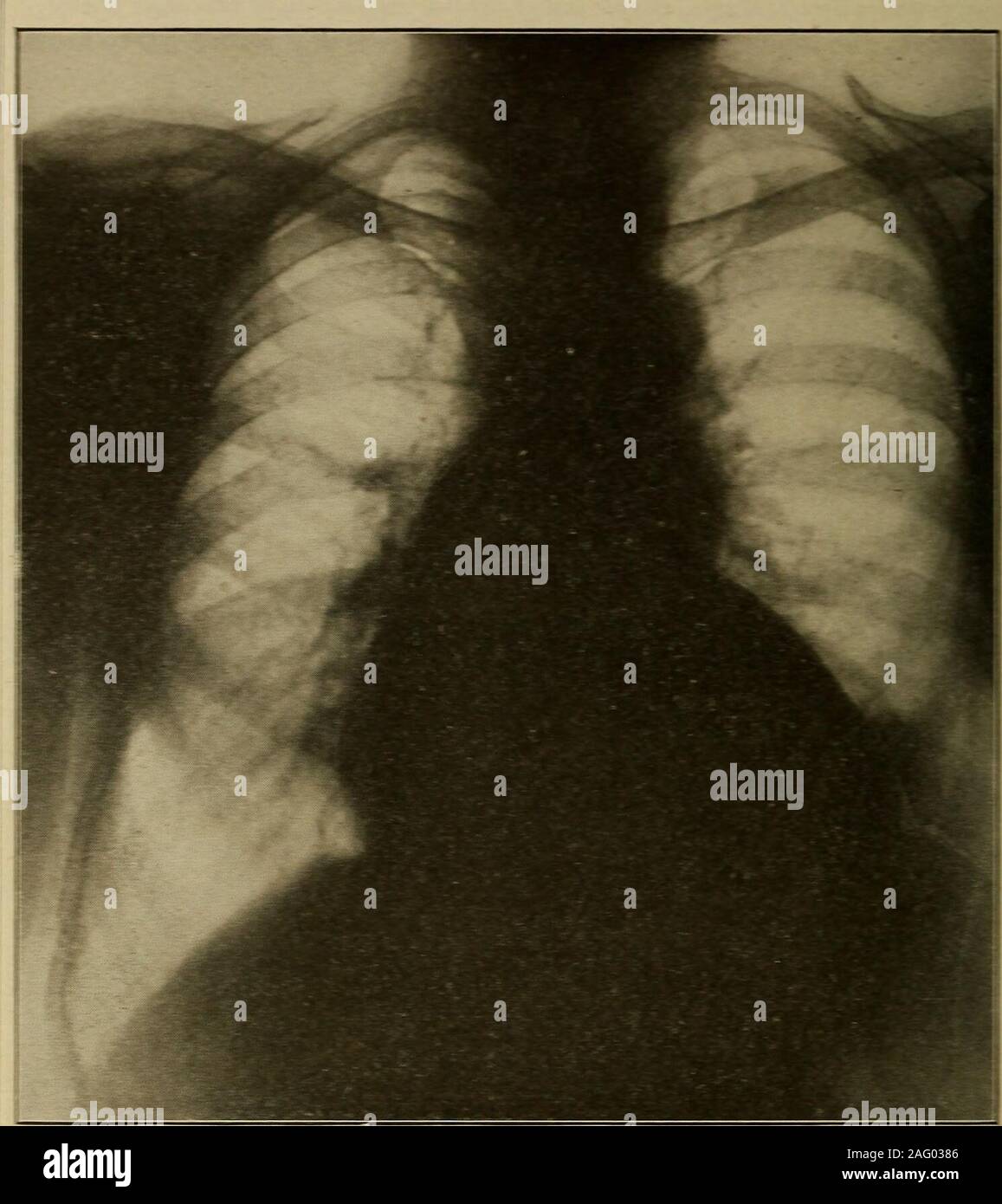 Flexion of the forearm hi-res stock photography and images - Alamy