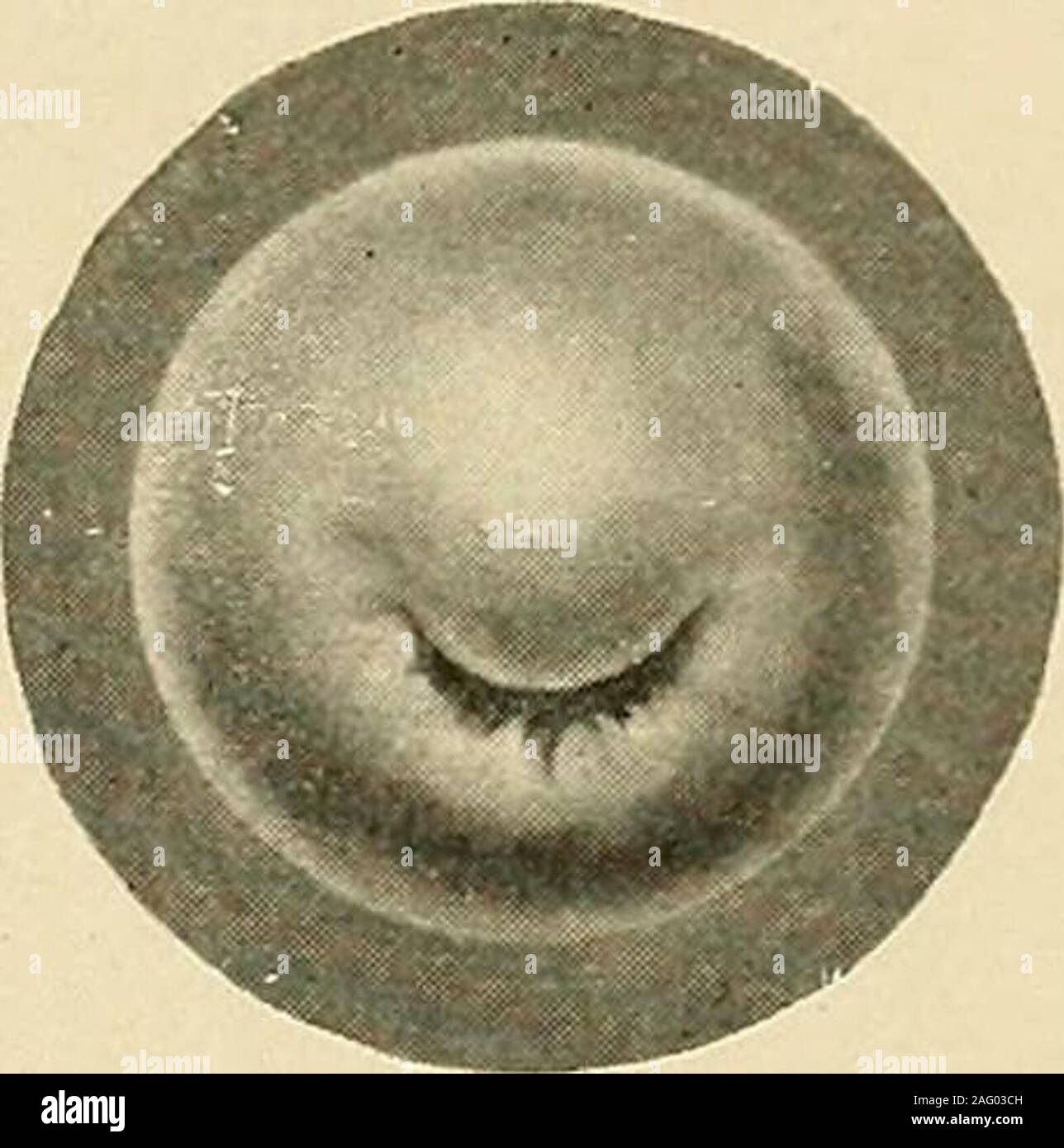 . The diagnosis and treatment of diseases of women. Fig. 432. Fig. 4.33 ...
