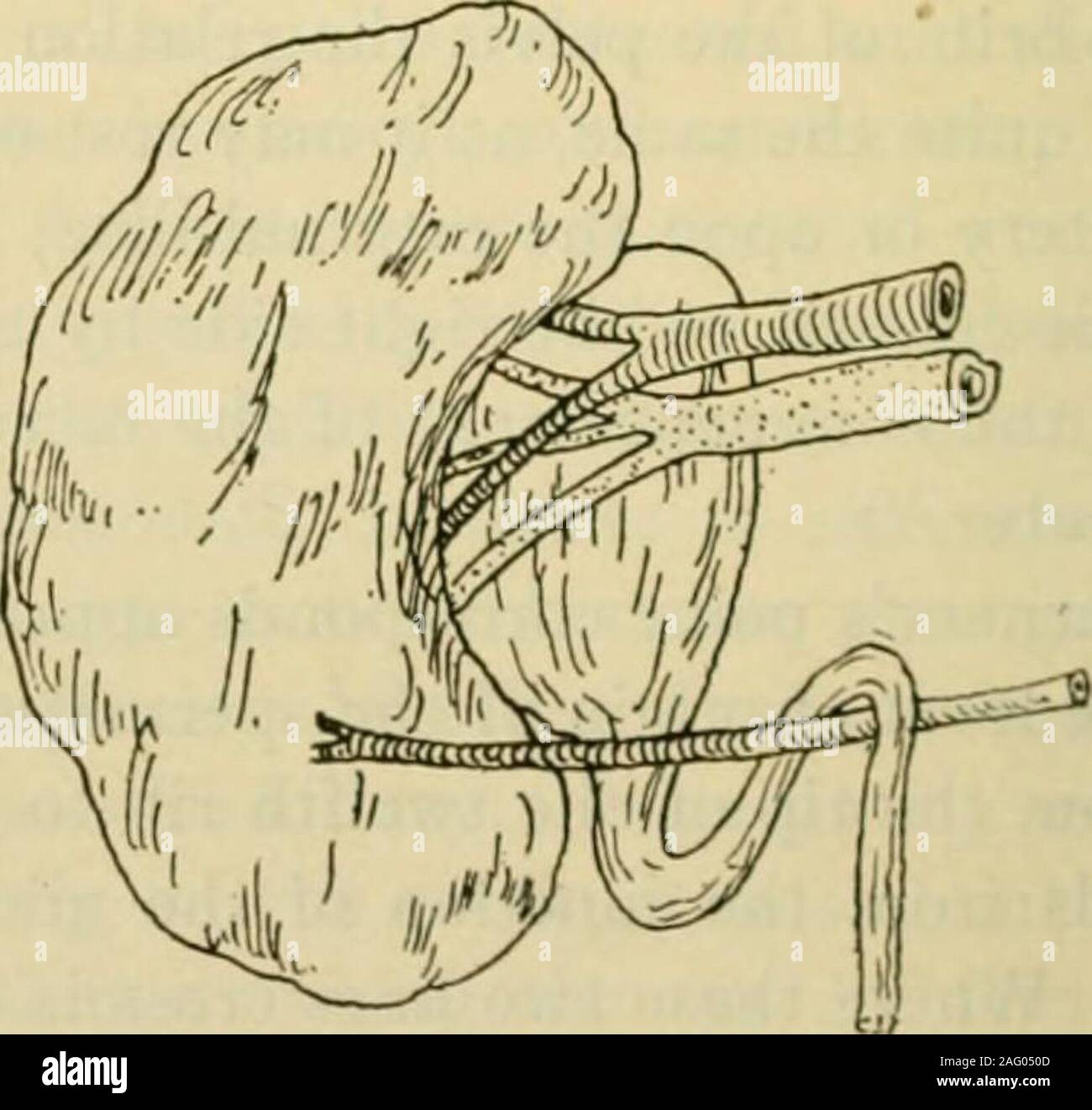 . Manual of operative surgery. Fig. 804.—(Eckehorn.). Fig. 805.—(5azv ...