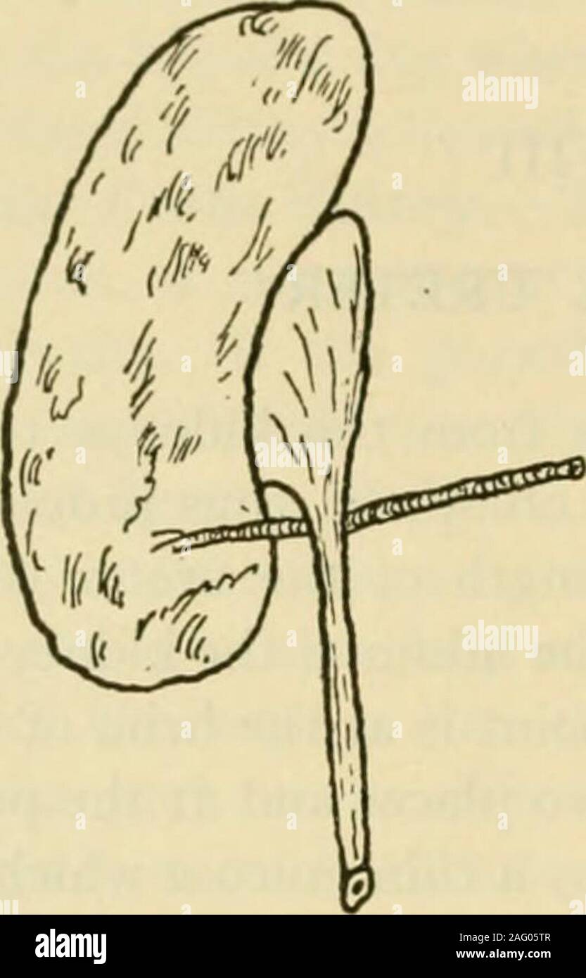 . Manual of operative surgery. neupwards from the junction of the ...