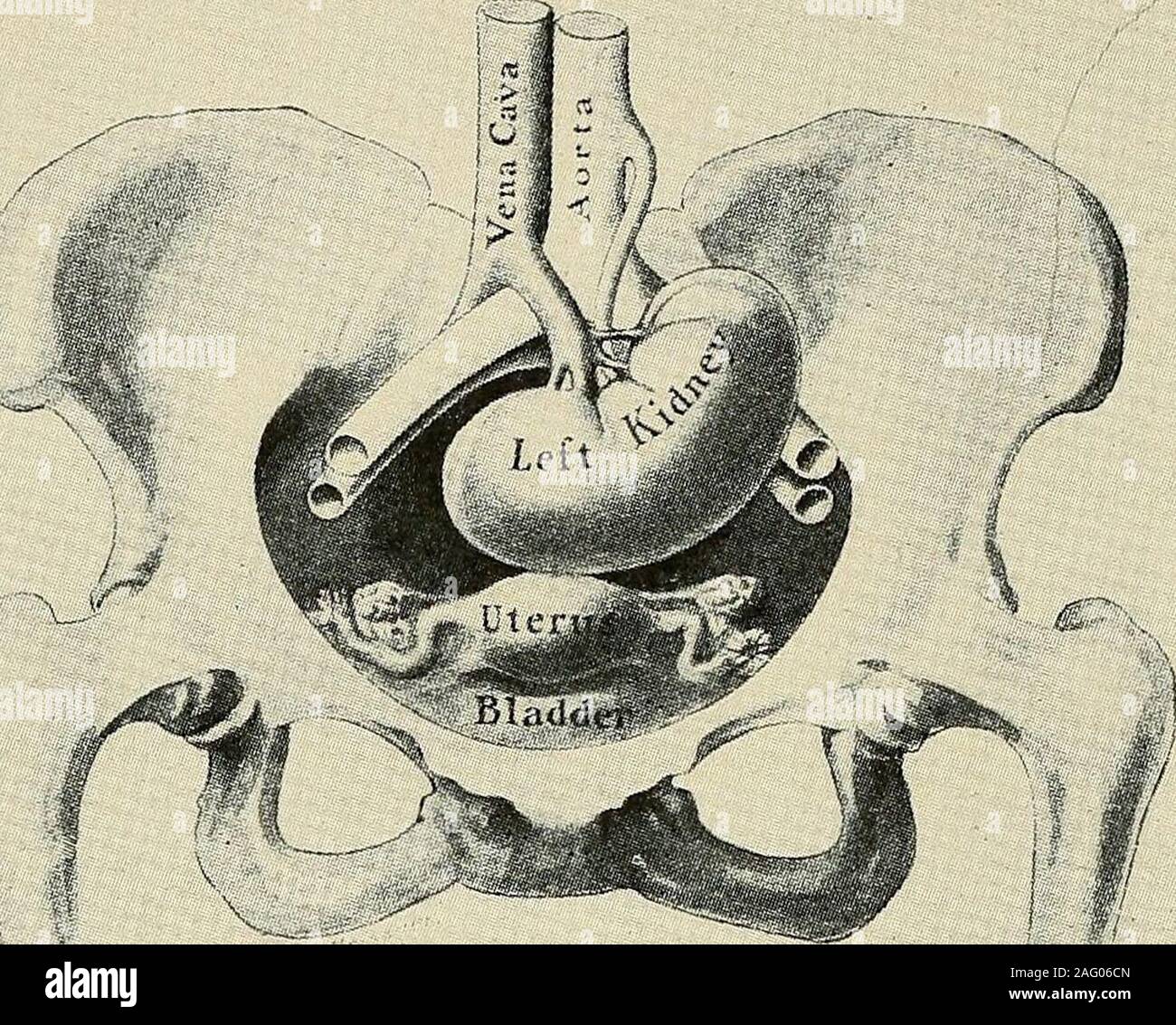 Lithopedion hi-res stock photography and images - Alamy