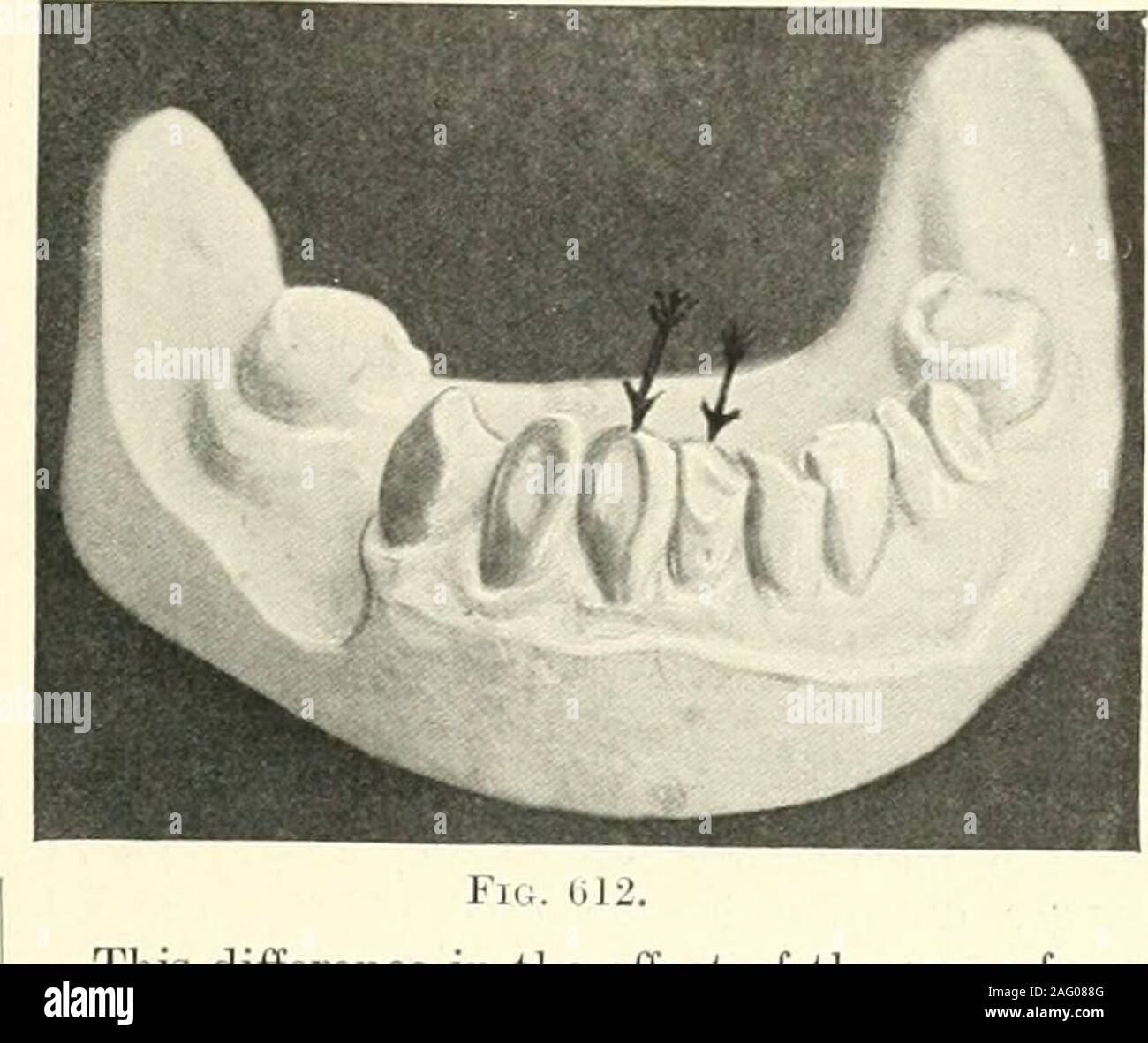 . The science and practice of dental surgery. Fig. lill. pletely ...