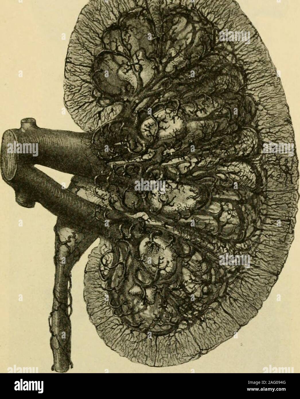 Renal sinus hi-res stock photography and images - Alamy