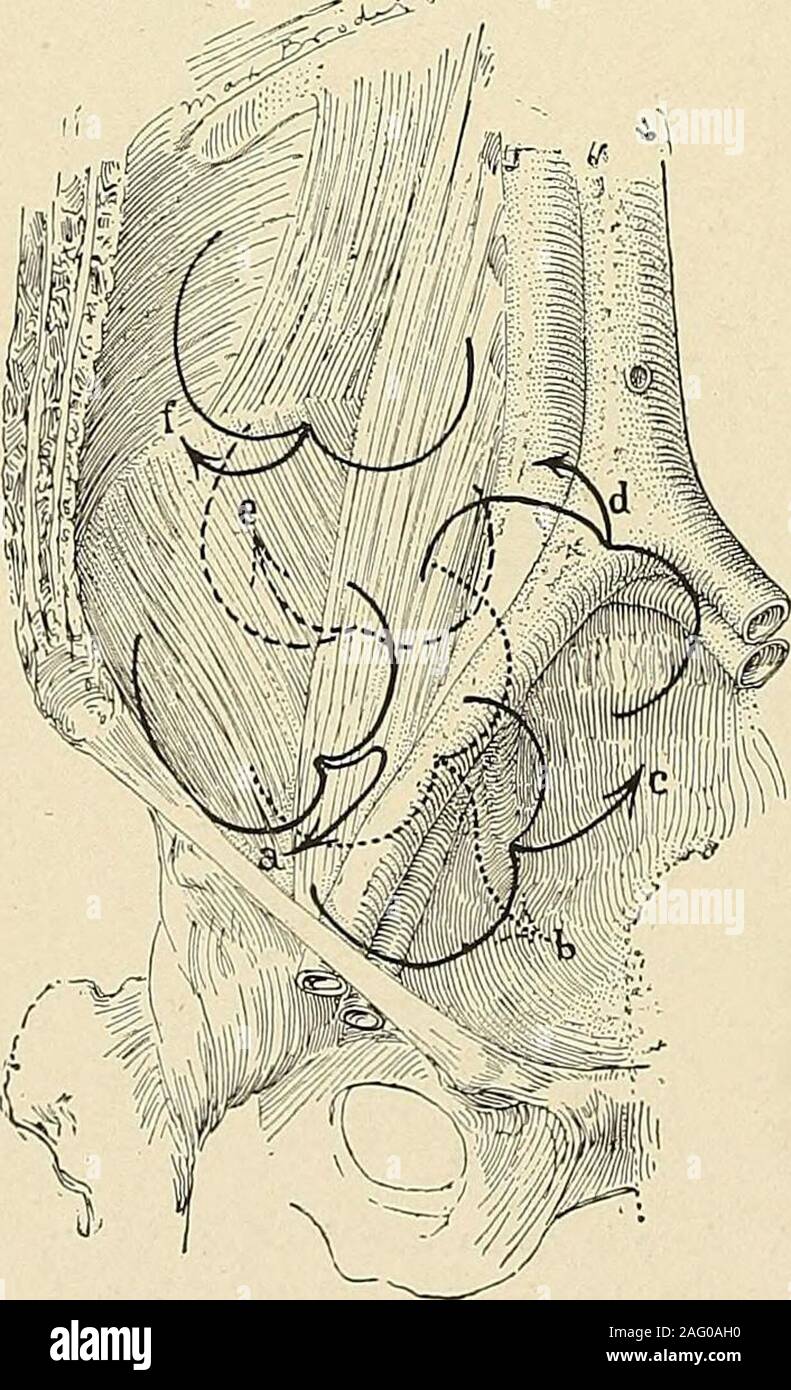 . The diagnosis and treatment of diseases of women. 410. Diagram ...