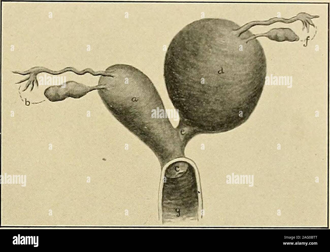 . The diagnosis and treatment of diseases of women. ic exudate and ...
