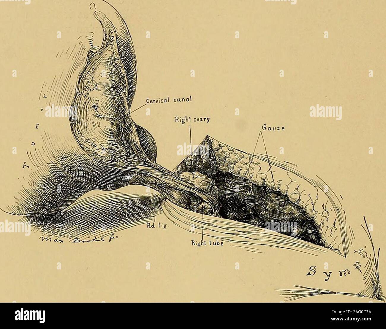 Round ligament of uterus hi-res stock photography and images - Alamy