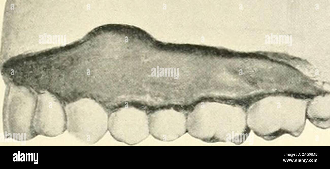 Deep pockets hi-res stock photography and images - Alamy