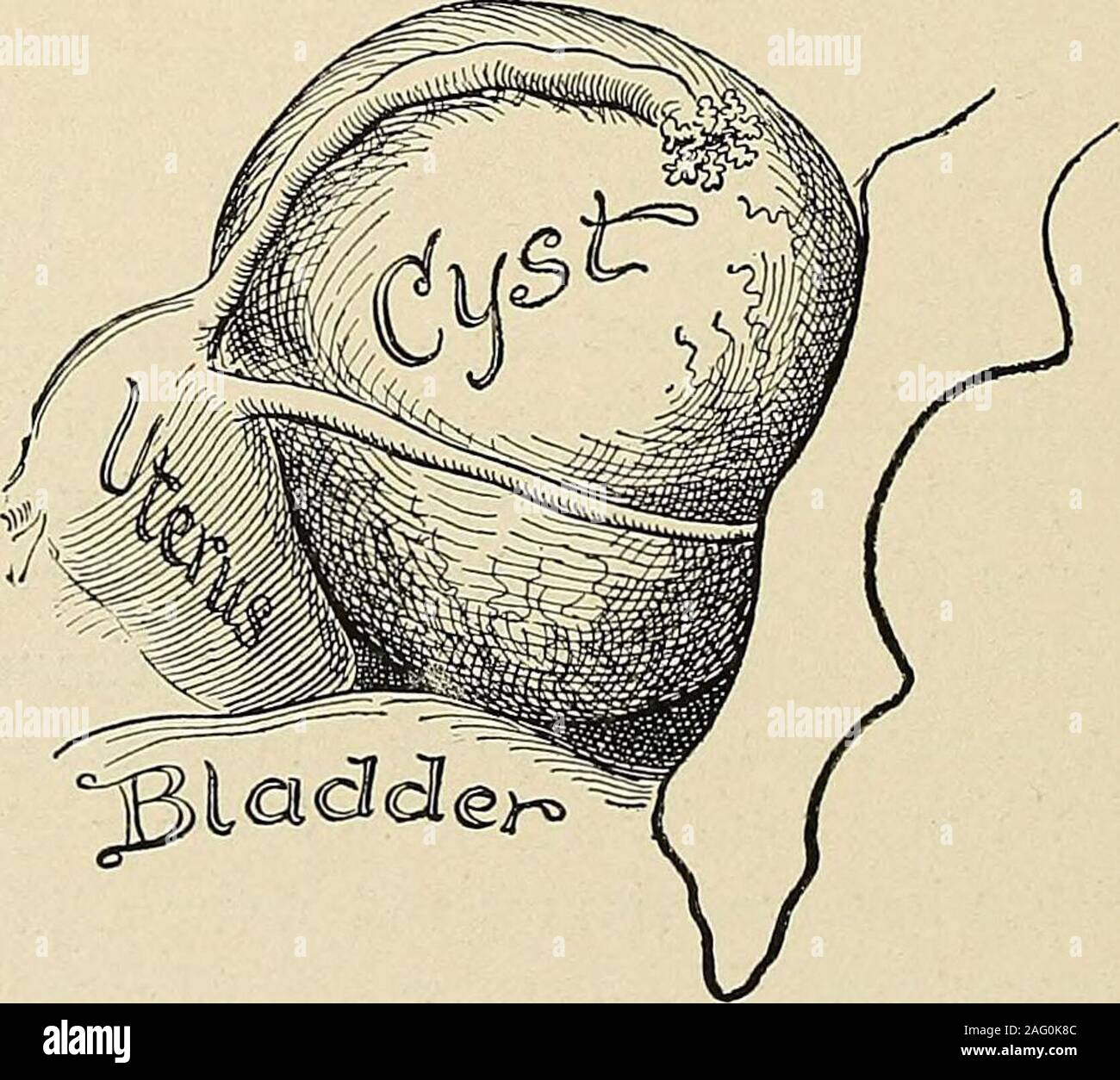 Broad ligament of the uterus hi-res stock photography and images - Alamy