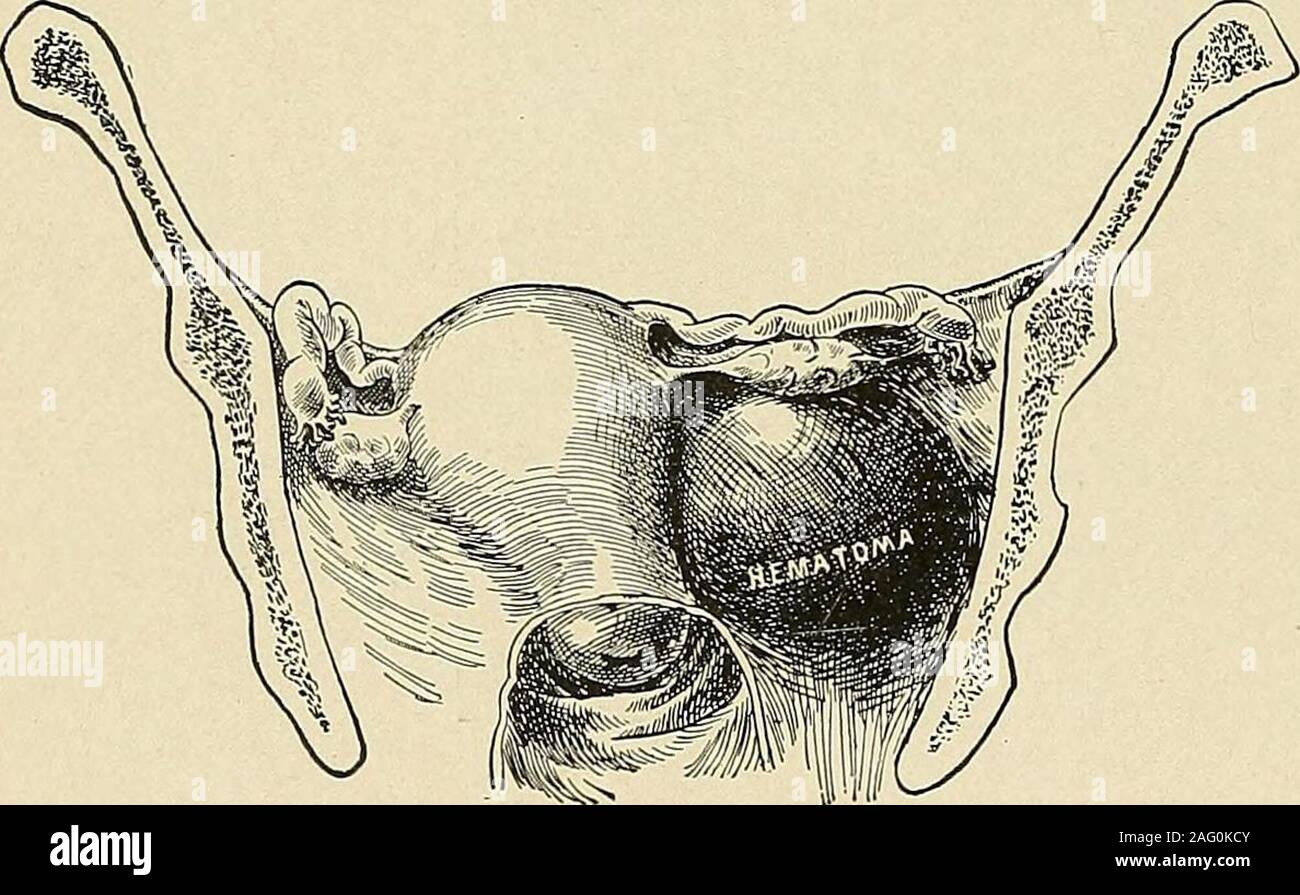 Blood collection area blood collection hi-res stock photography and ...