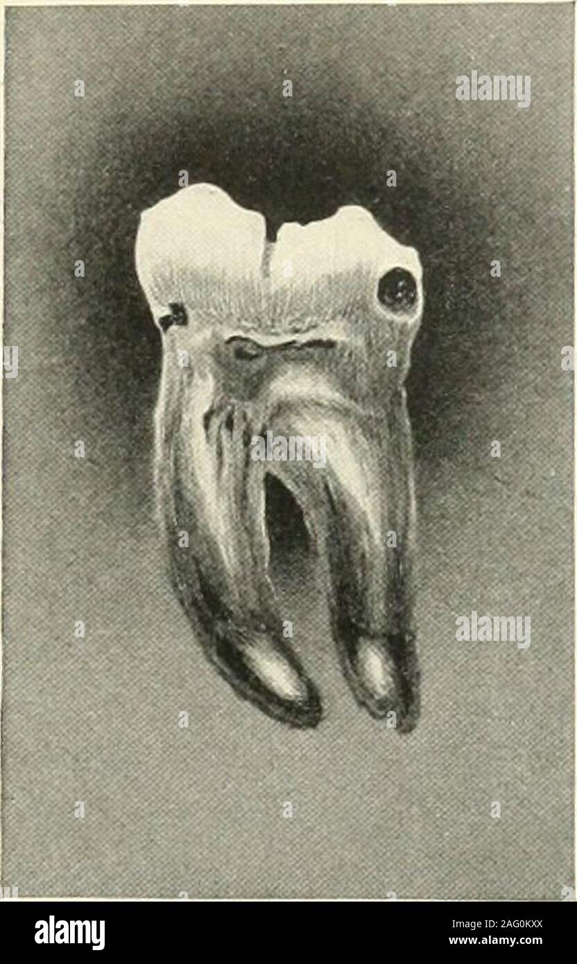 . The science and practice of dental surgery. shows a section of a ...
