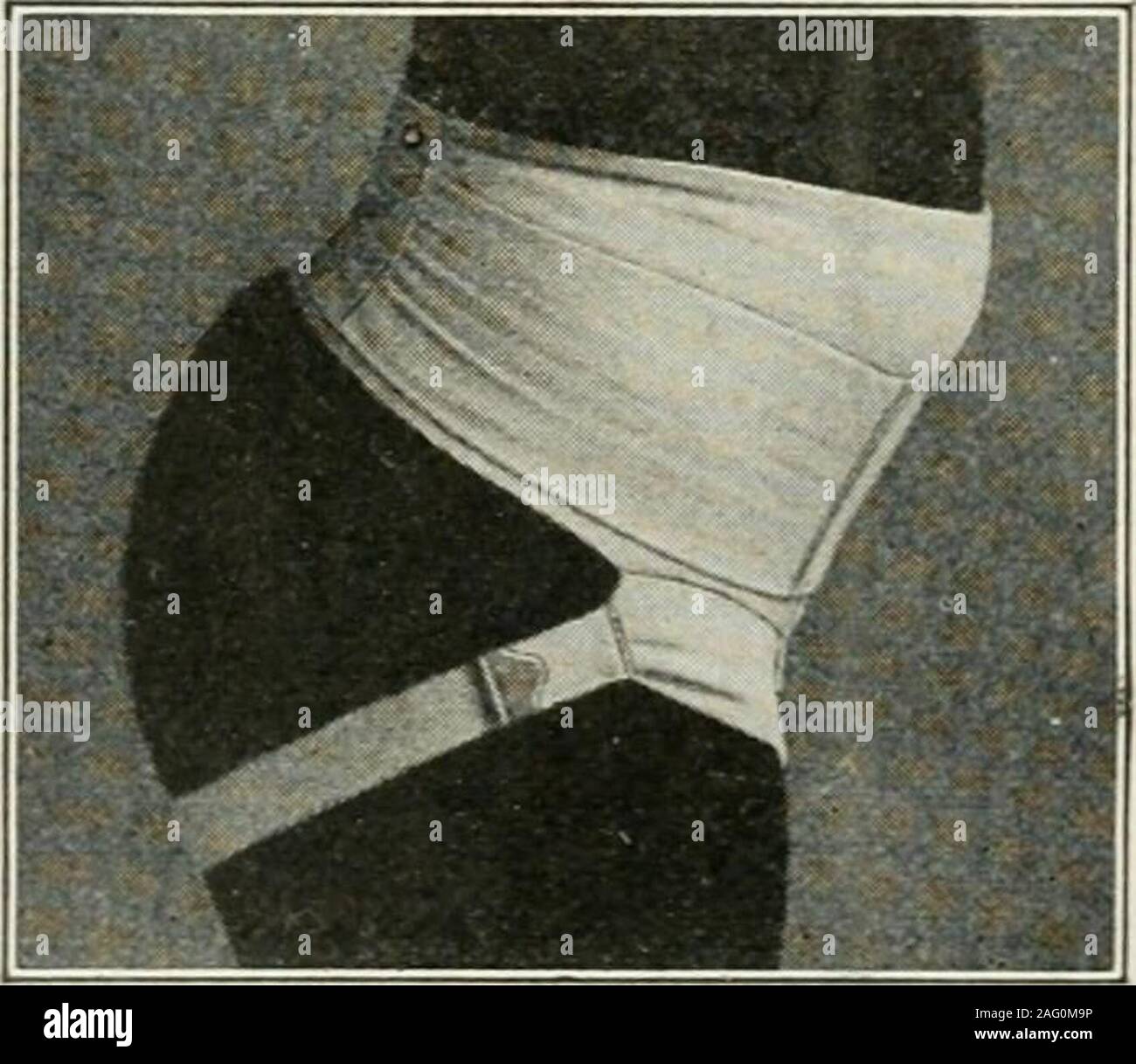 Anasarca hi-res stock photography and images - Alamy