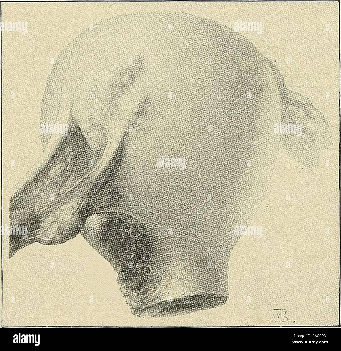 . The diagnosis and treatment of diseases of women. Fig. 376. Single ...