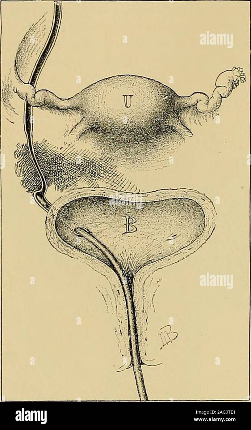 . Operative gynecology. l incision made,varying in its length according ...