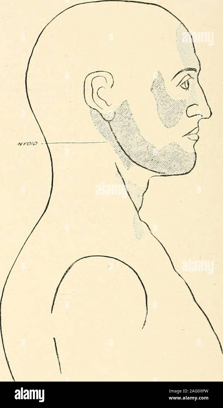 Lateral canthus hi-res stock photography and images - Alamy