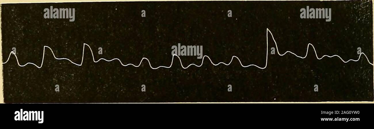 . Heart disease, with special reference to prognosis and treatment. f ...