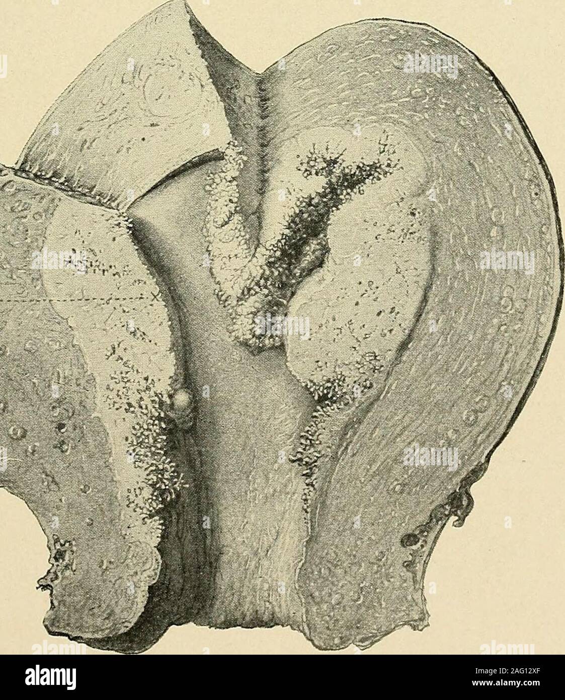Uteri hi-res stock photography and images - Alamy