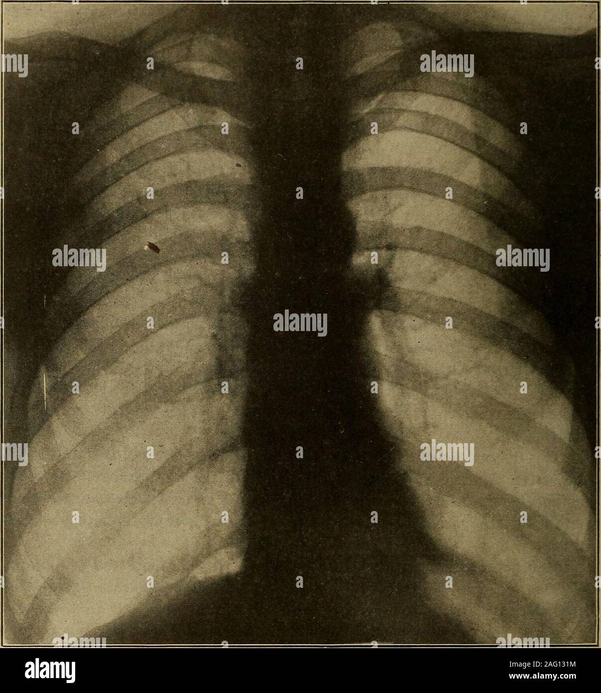 . Medical diagnosis for the student and practitioner. e tube box and ...
