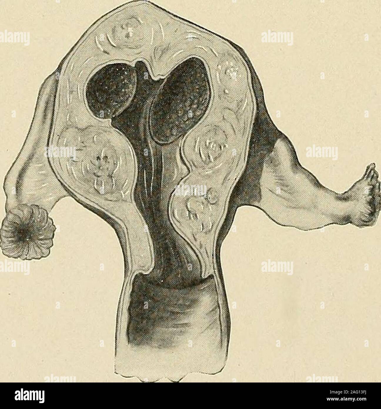 . The diagnosis and treatment of diseases of women. flammation or to ...