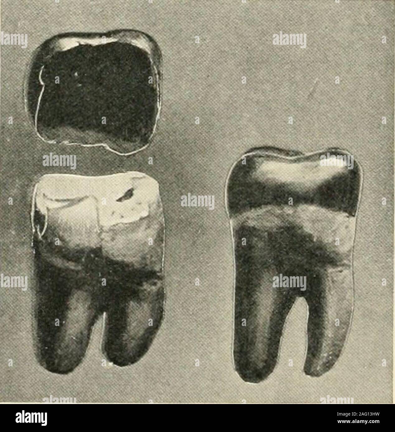. The science and practice of dental surgery. Fig. 502. needs for ...
