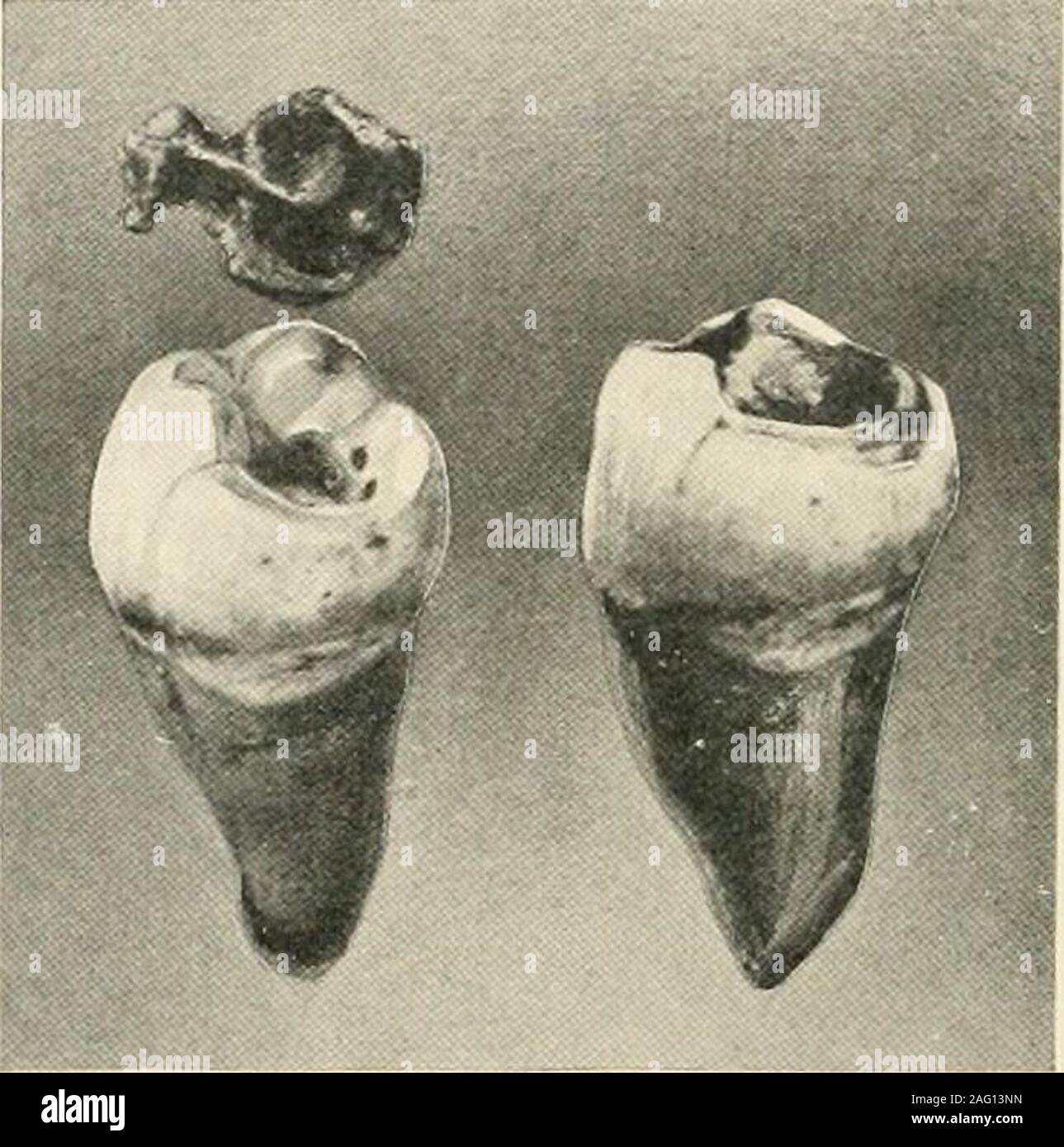 Un molar hi-res stock photography and images - Alamy
