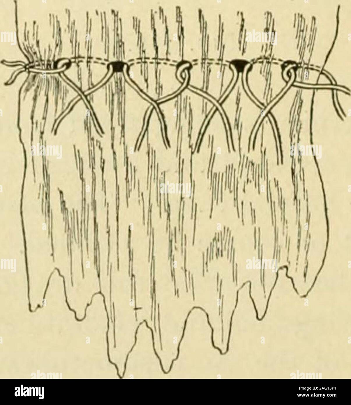 . Manual of operative surgery. he palm of the finger and pushed along ...