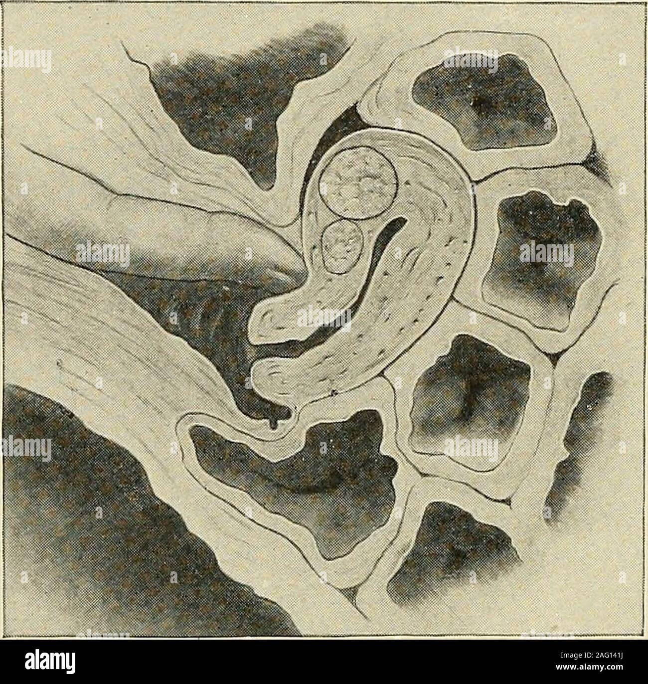 . The diagnosis and treatment of diseases of women. Fig. 354. Palpating ...