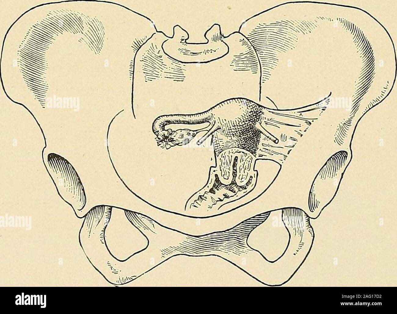 . The diagnosis and treatment of diseases of women. Fig. 346. Uterus ...