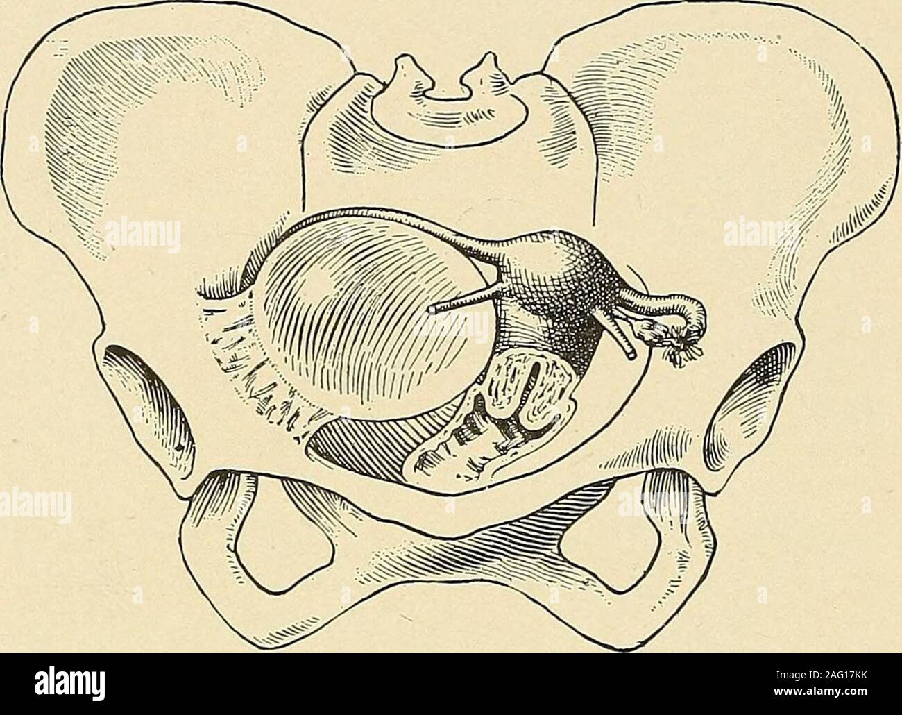 . The diagnosis and treatment of diseases of women. Fig. 344. Uterus ...