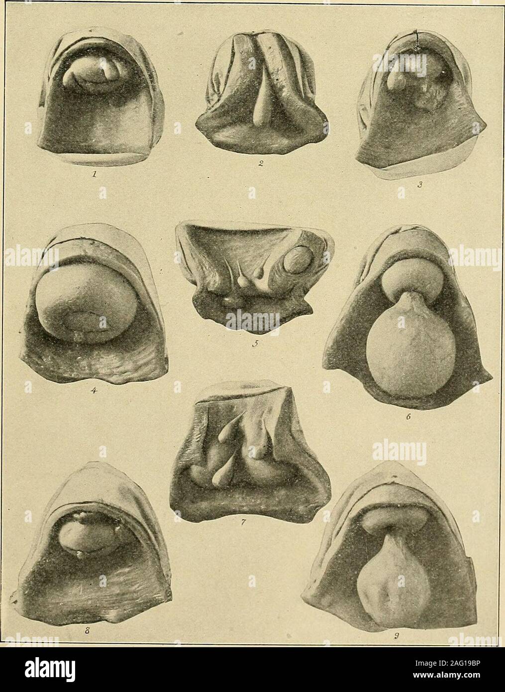 . The diagnosis and treatment of diseases of women. Tenderness of the ...