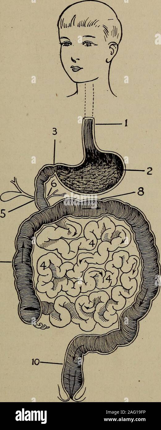 Collodion baby hi-res stock photography and images - Alamy