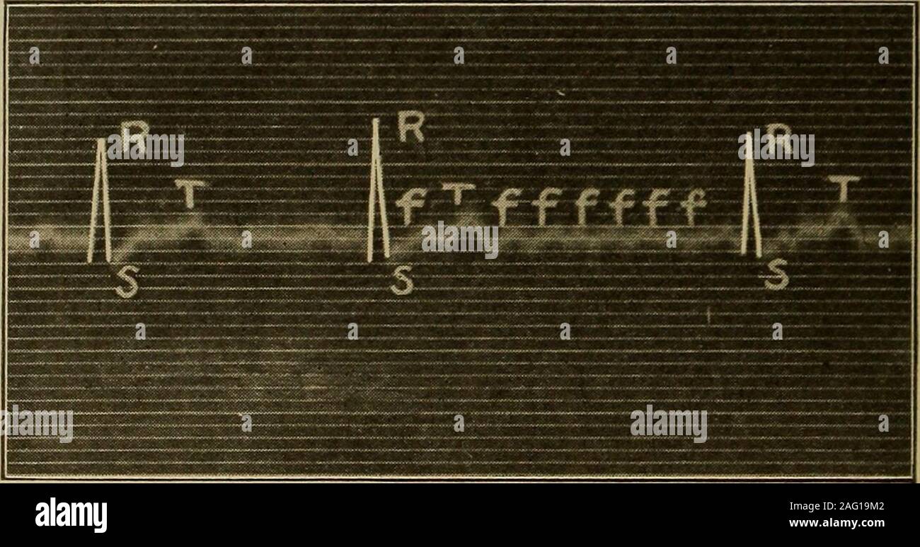 . Medical diagnosis for the student and practitioner. Fig. 258.—Lead ...