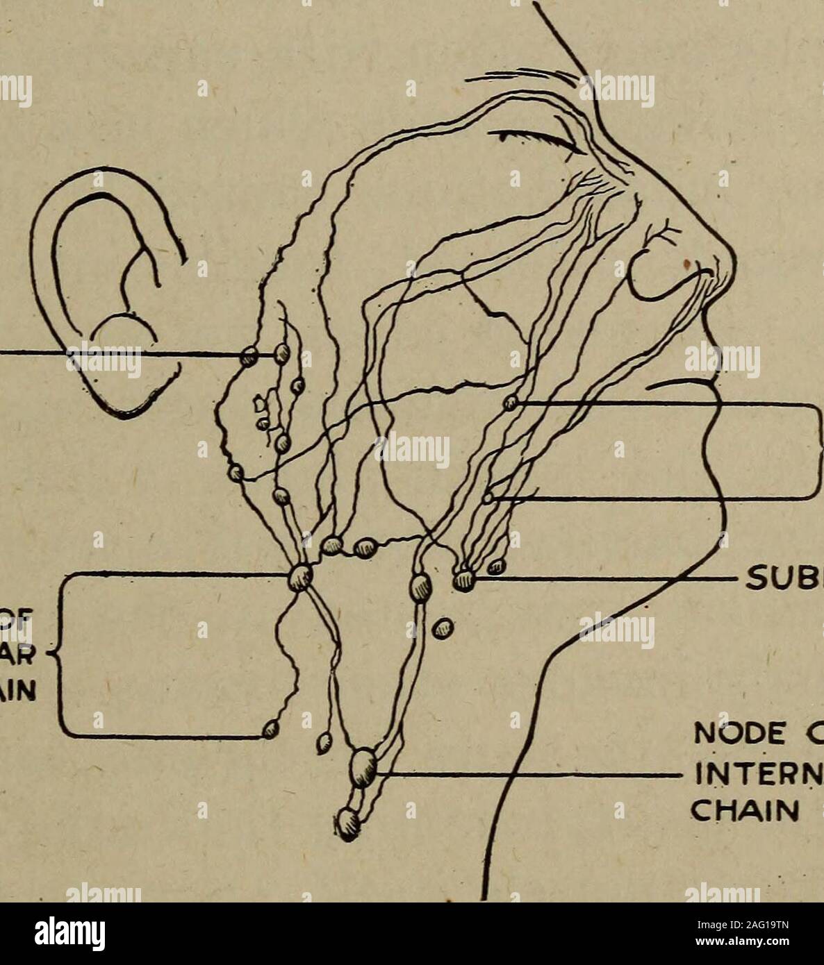 . Diseases of infancy and childhood. PAPOTID NODES OF EXTERNAL JUGULAR ...