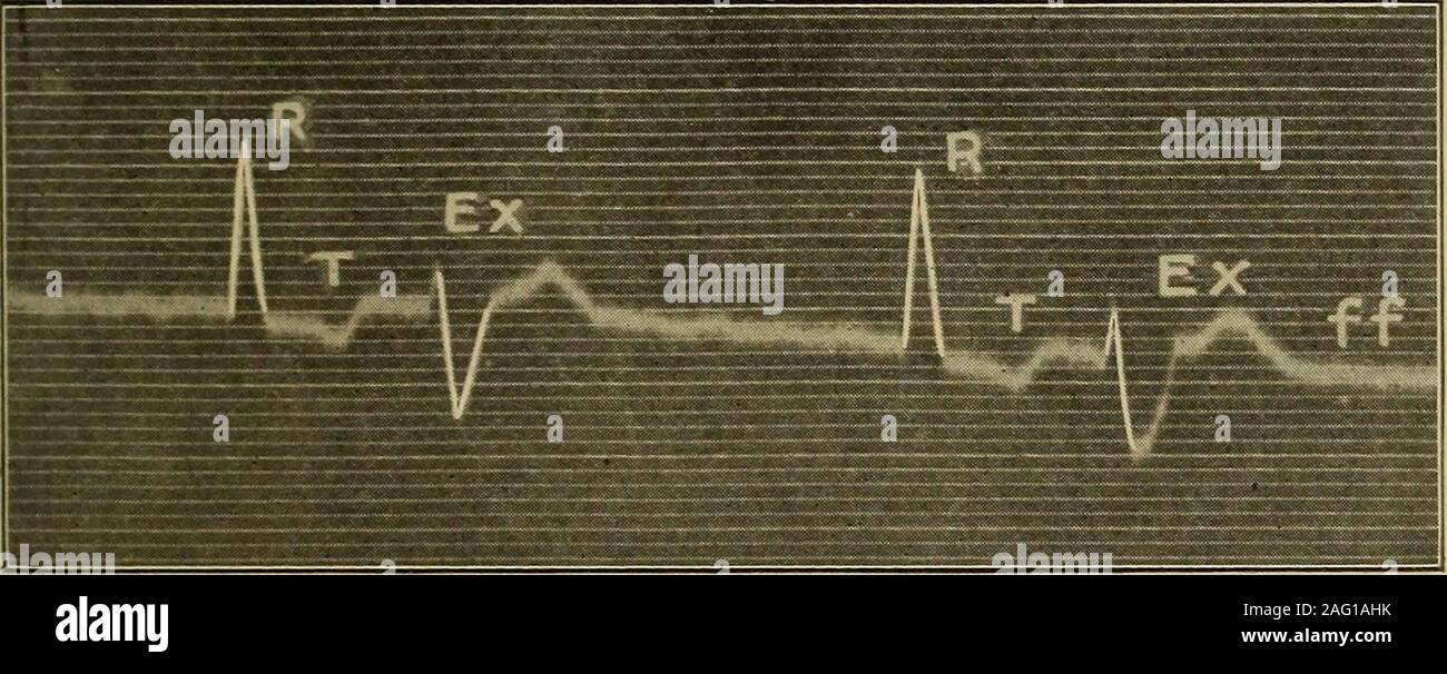 . Medical diagnosis for the student and practitioner. Fig. 256. -Normal ...