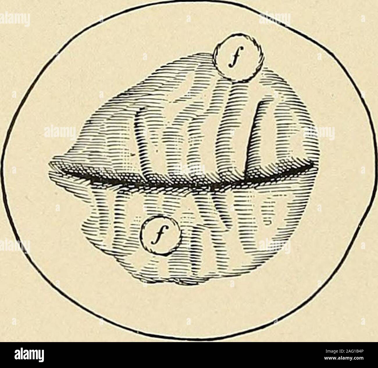 . The diagnosis and treatment of diseases of women. Fig. 336. Side View ...