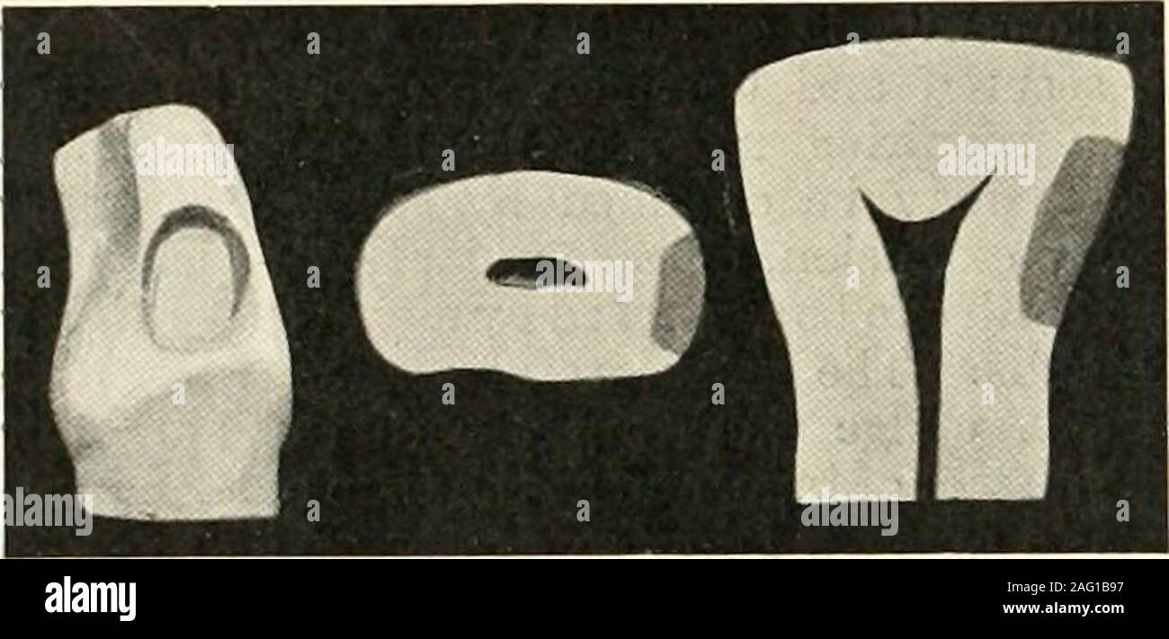 . The science and practice of dental surgery. Fig. 466.—Diagrammatic ...