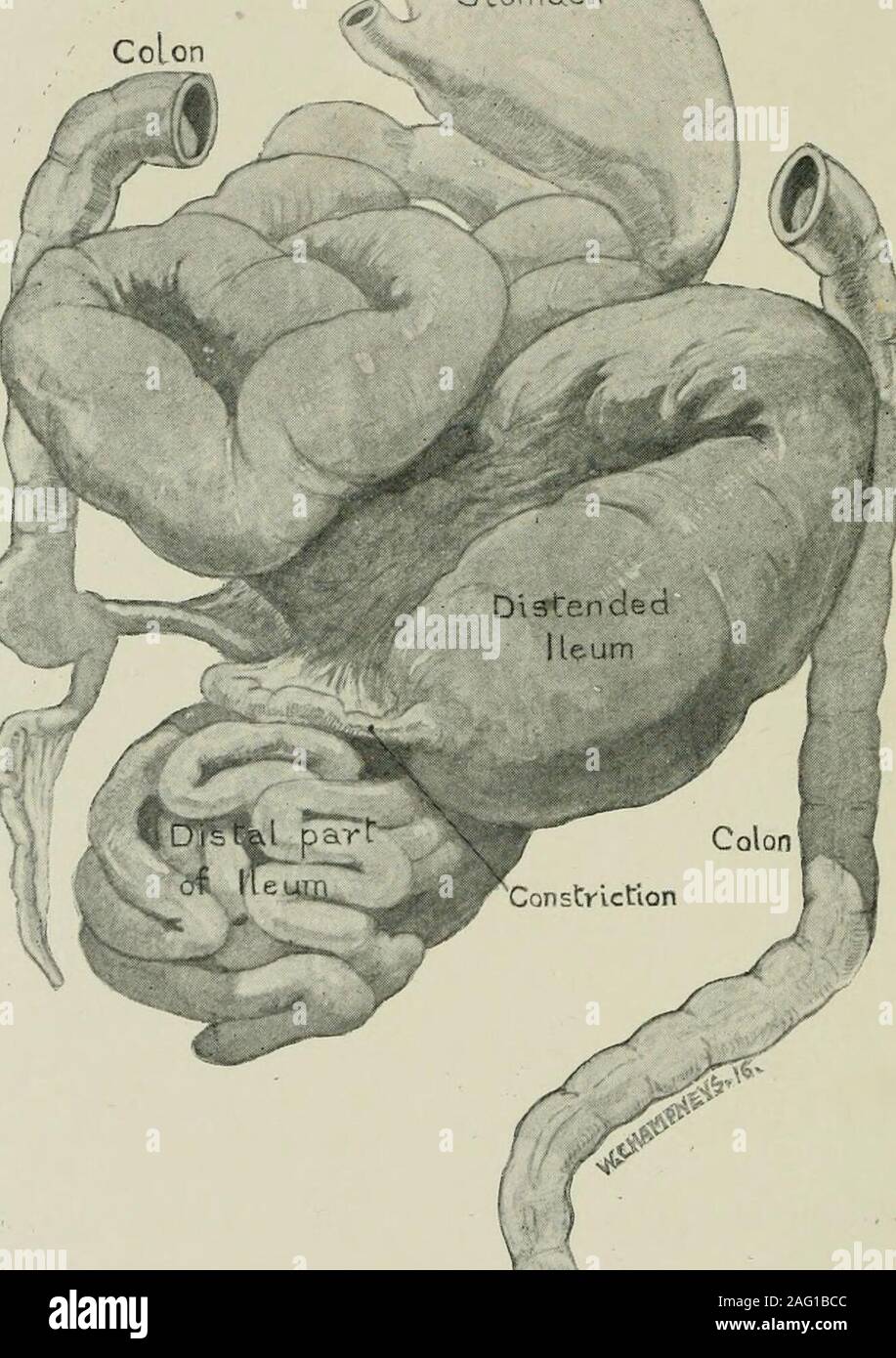 Anatomy and post mortem hi-res stock photography and images - Alamy