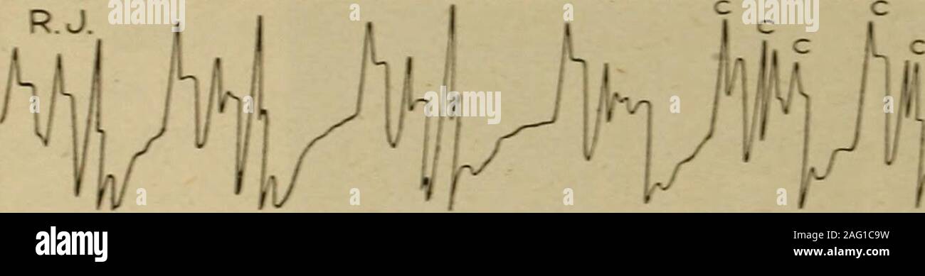 Polygram hi-res stock photography and images - Alamy