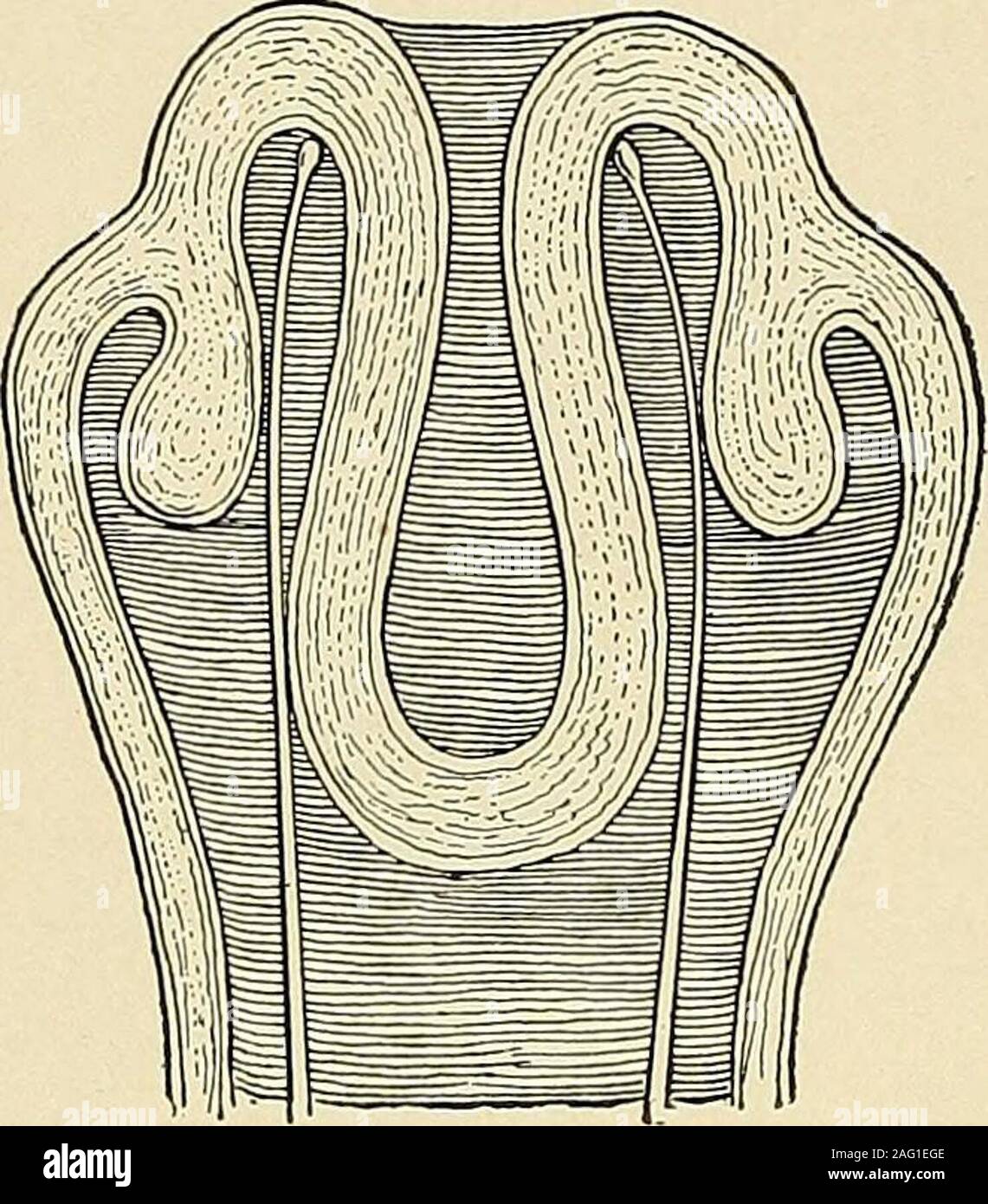 Cervical ring hi-res stock photography and images - Alamy