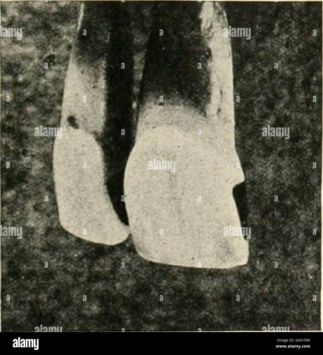 . The science and practice of dental surgery. Fig. 448. medial filling ...