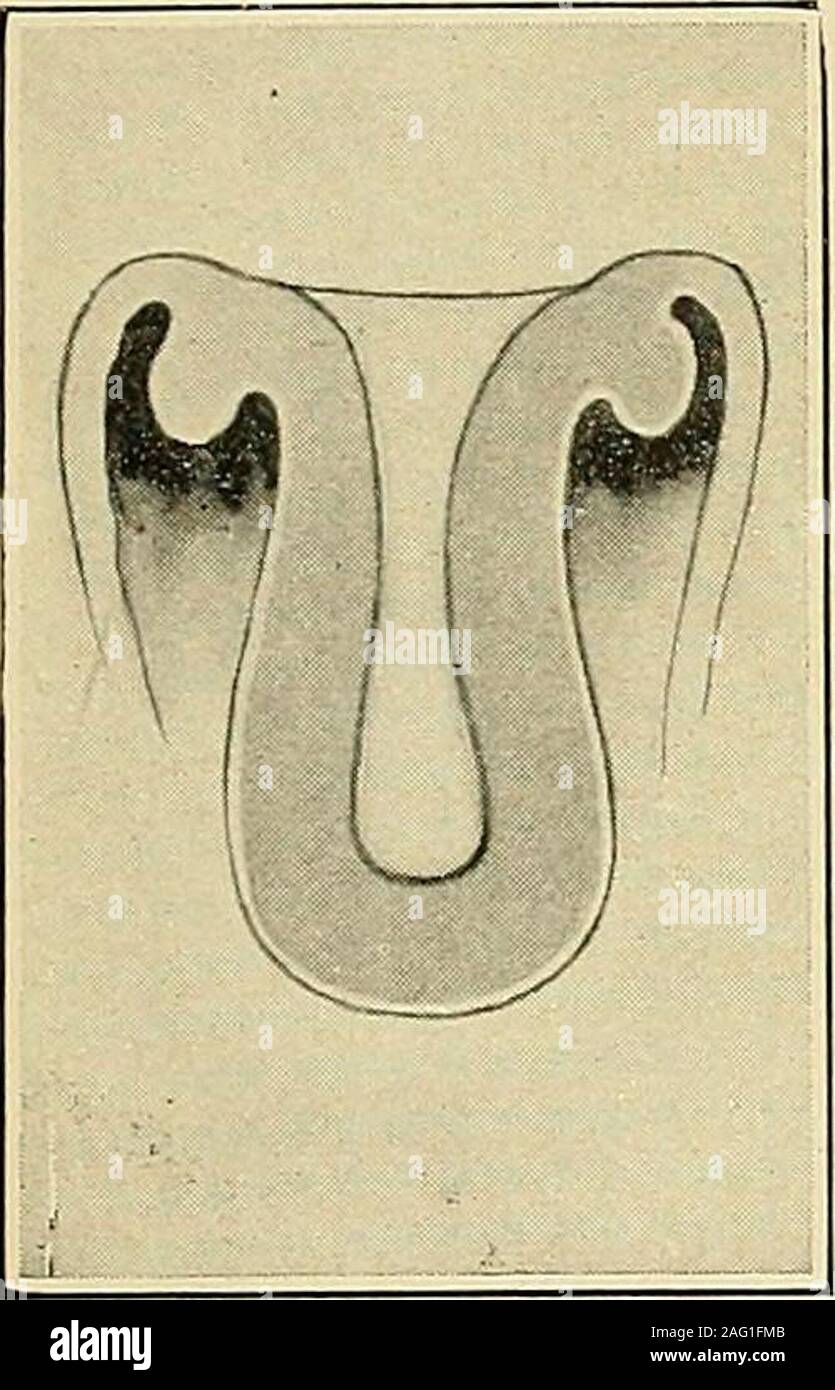 Long pedicle hi-res stock photography and images - Alamy