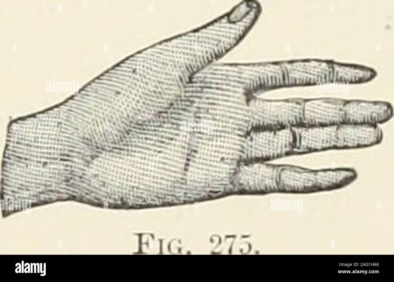 Righthand turn hi-res stock photography and images - Alamy