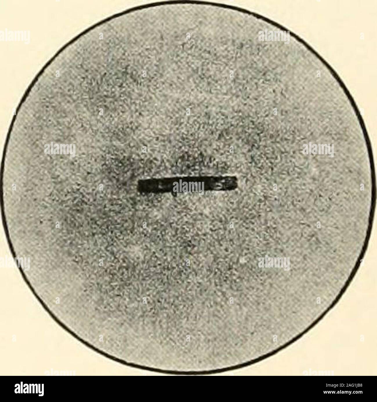 Gold amalgams hi-res stock photography and images - Alamy