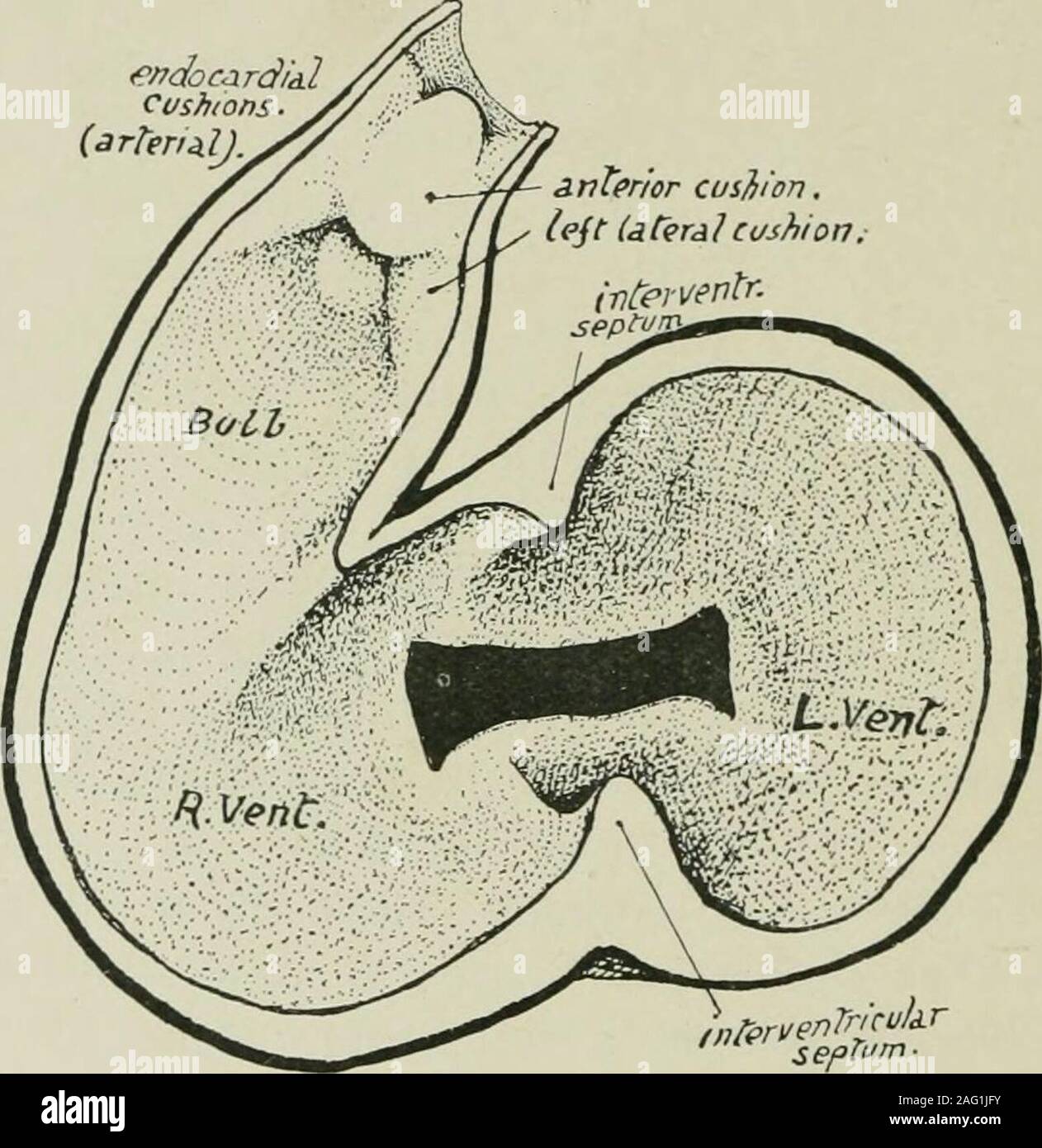 Interventricular Septum